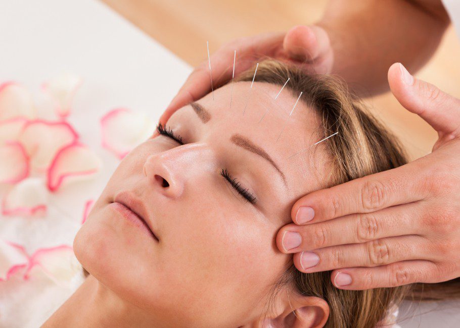 Cosmetic Acupuncture - The Well Clinic